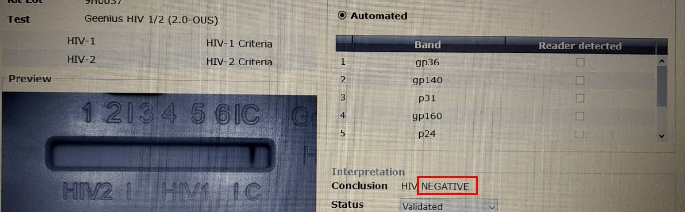 2025 HIV-ICT AIDS愛滋抗體免疫層析確認試驗